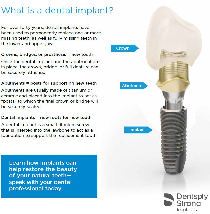 Implant Abutment Placement WHAT IS THE IMPLANT PLACEMENT PROCESS?